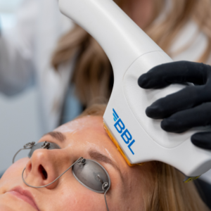 Sciton | BBL® Hero™ Broadband Light Laser Technology