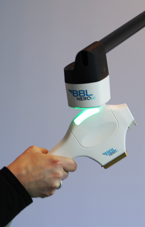 Sciton | BBL® HEROic the Breakthrough Pulsed Light Technology